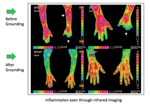 Does Grounding Really Work? The Science of Earthing and Inflammation
